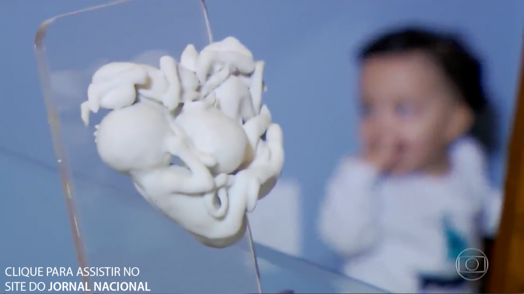 Feto 3D - Artes & Design | PUC-Rio